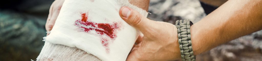 Emergency Room For Cuts, Lacerations, Scrapes & Gashes Treatment In ...